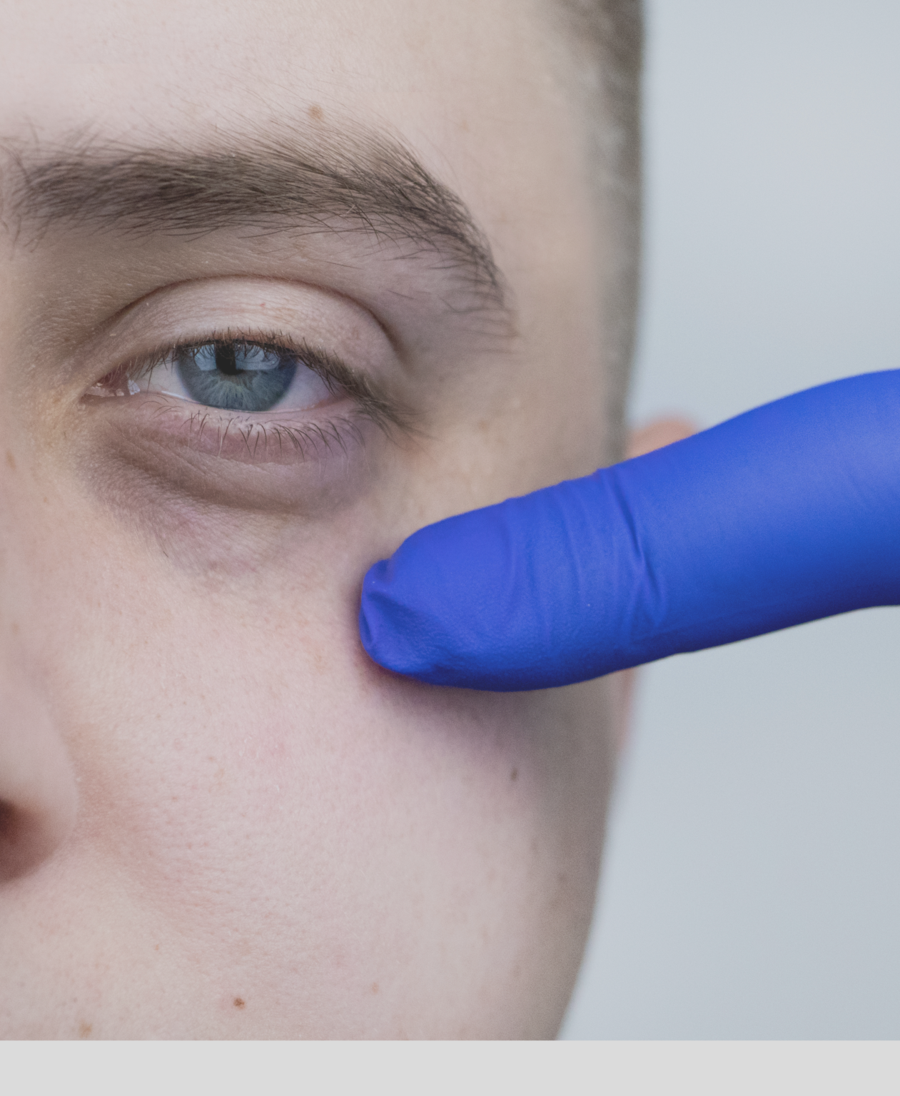 Non-Surgical Eye Bag Removal – DR Baby Face